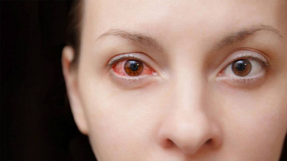 Omicron new 7 main symptoms appear in eyes | ஜாக்கிரதை; ஒமிக்ரானின் ...