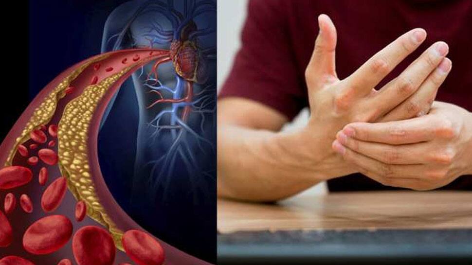 Health Alert: High Cholesterol Warning Signs in Hands | உடலில் ...