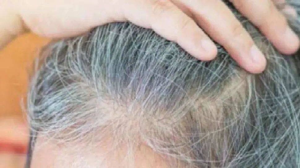 Natural Ways to get Rid of Grey Hair Issue | நரைமுடி பிரச்சனையா ...