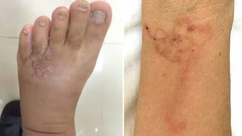 A Woman Shocked to See Worms Swimming Under her Skin | சருமத்தின் கீழ் ...