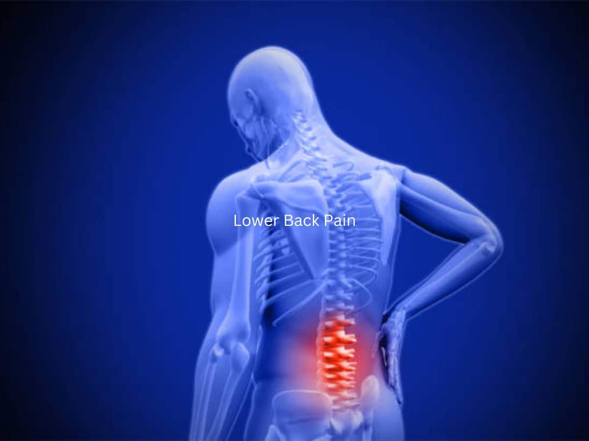 Understanding and Alleviating Lower Back Pain: Causes and Solutions ...