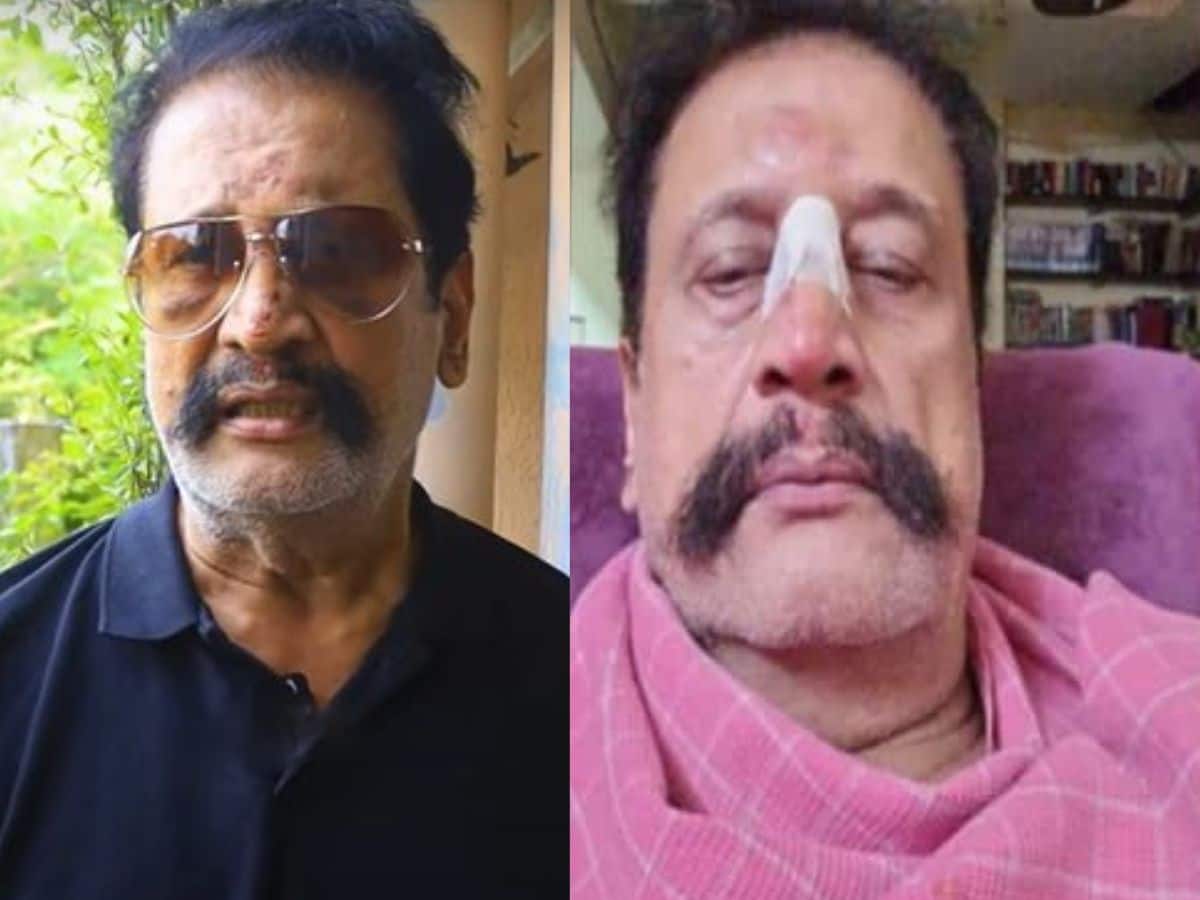 Actor Mohan Sharma Attacked In Chennai Read Details In Tamil | பிரபல ...