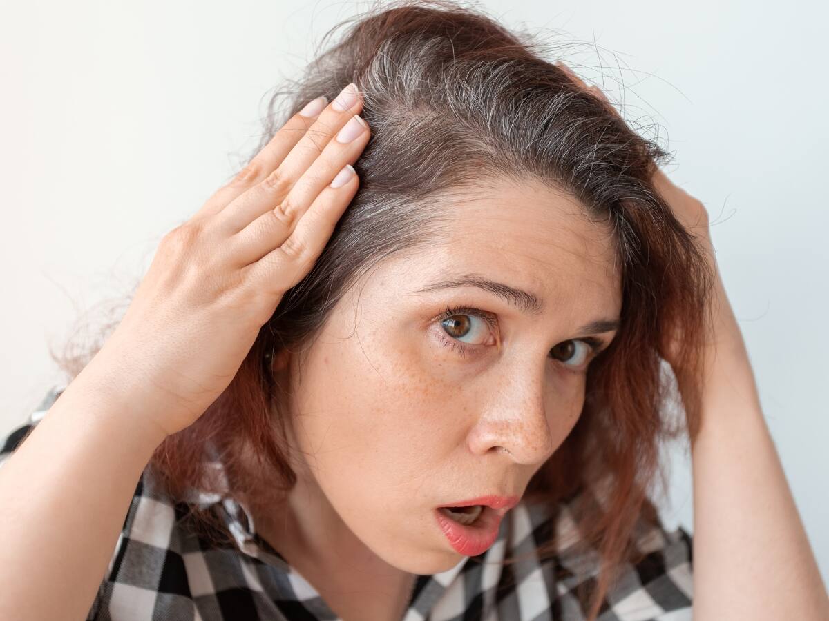 Some causes for White or grey hair issue | இளநரை பிரச்சனையா ...