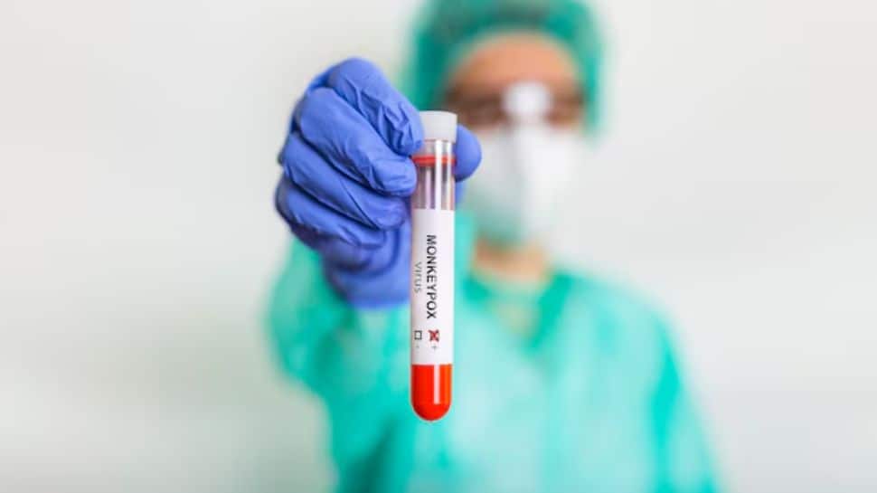 Monkeypox Goes Out of Africa: First Case Found in Sweden ...