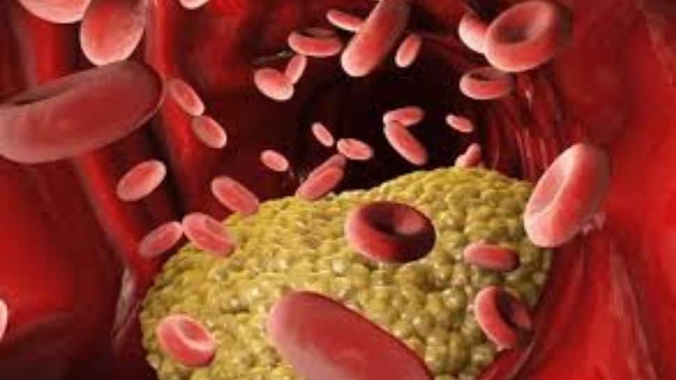 Best Food to Control Cholesterol: See Full List Here | கெட்ட ...