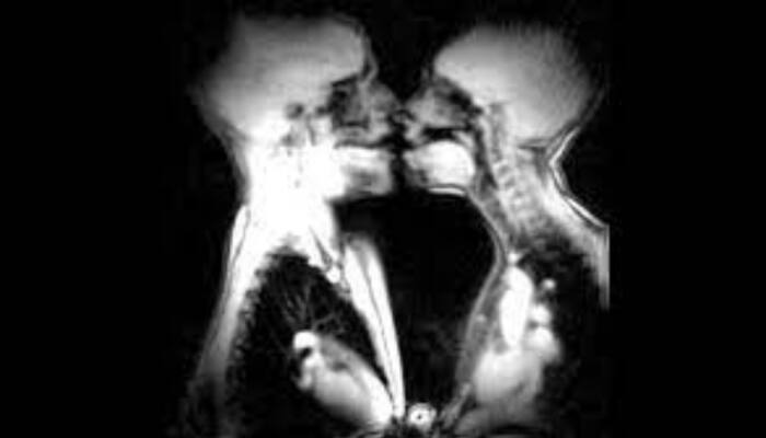 Viral Video : முத்தத்தால இவளோ விஷயங்கள் நடக்குமா! - ஆச்சரியமூட்டிய MRI ...